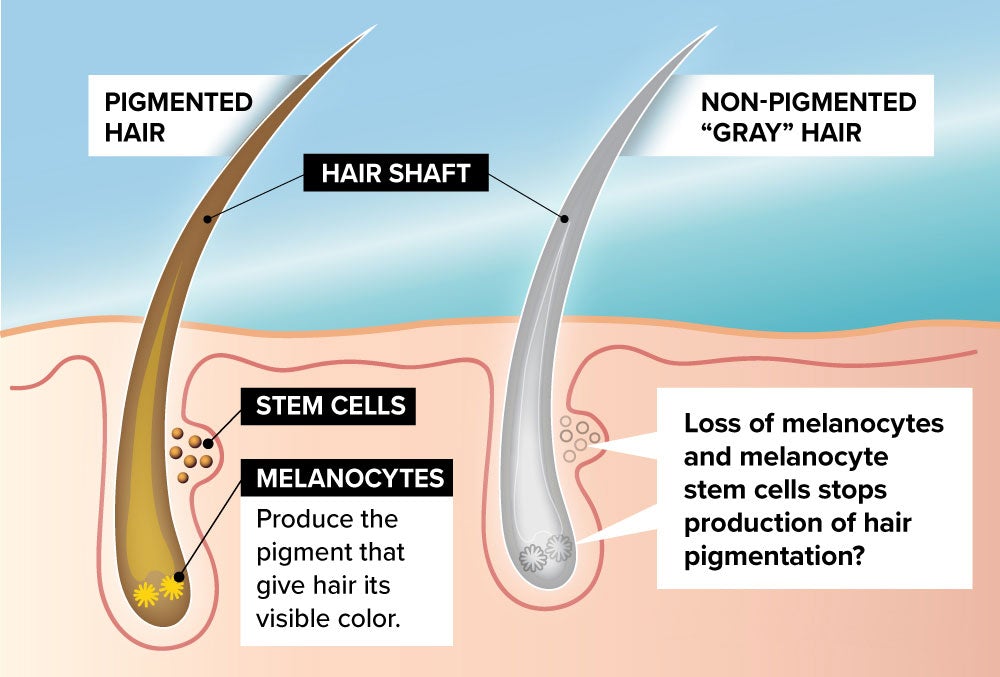 What Causes Grey Hair And How To Reverse It – Nutriop Longevity